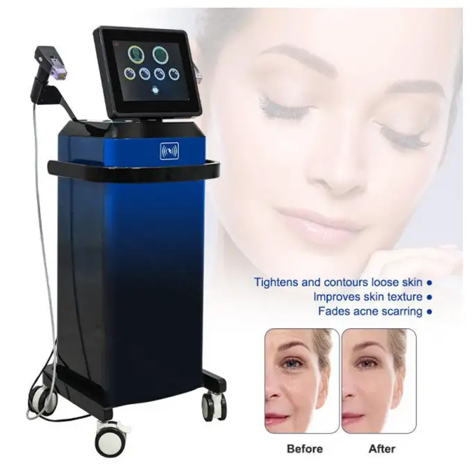 Needle Mode RF Micro Needle – Bros Lazer Medikal