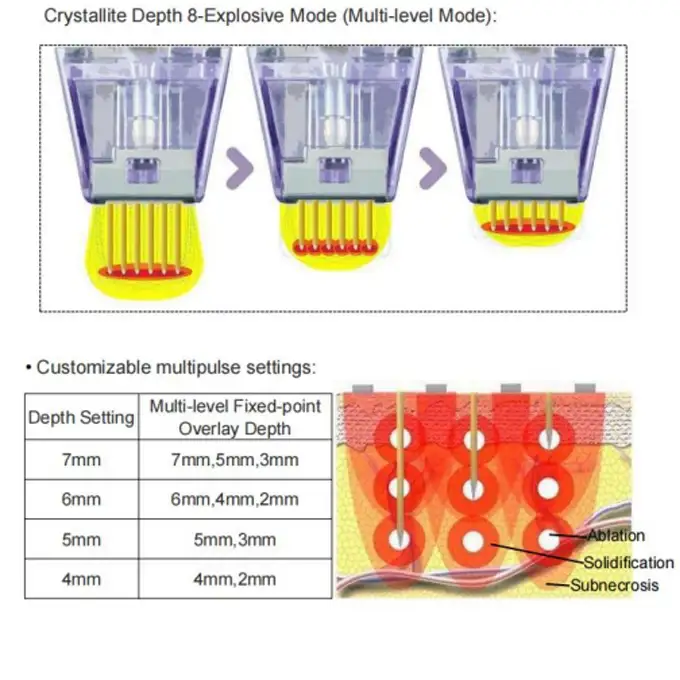 Needle Mode RF Micro Needle – Bros Lazer Medikal